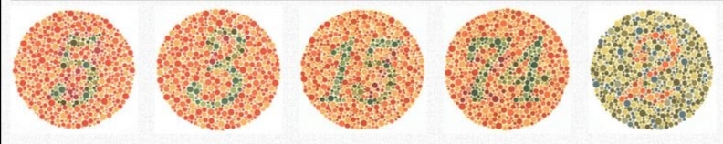 Test Daltonismo - Prueba online Gratuita